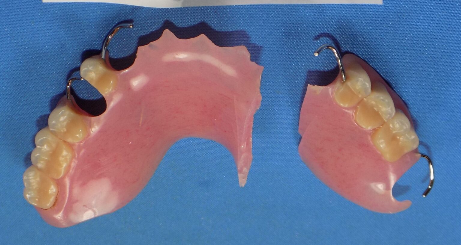 Expert Partial Denture & Flipper Repair | Denture Repair Lab