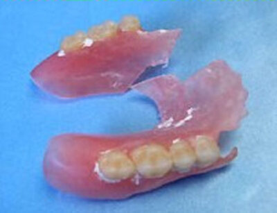 At Home Dental Impression Kit | Denture Repair Lab